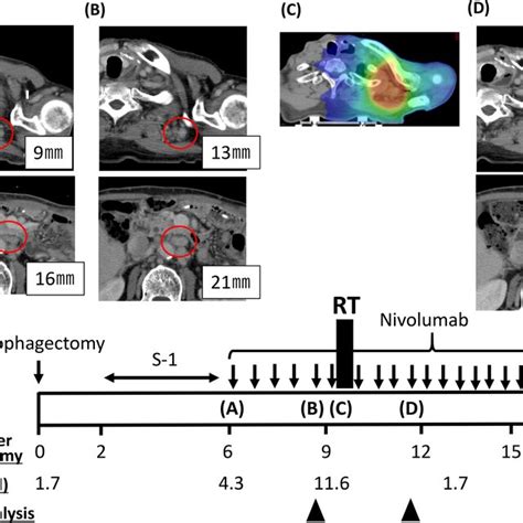 Results Of Diagnostic And Radiotherapy Simulation Imaging Throughout