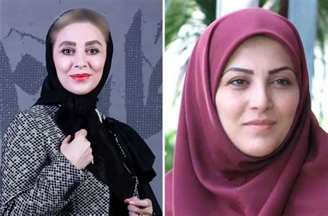 چهره باورنکردنی ژیلا صادقی بعد از 25 سال عکس قبل عمل زیبایی