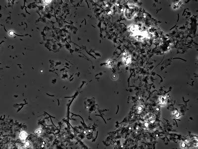 Of Bacteria And Men Bacteria In A Wastewater Treatment Plant