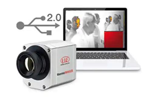 Contactless Body Temperature Measurement With A Thermal Camera