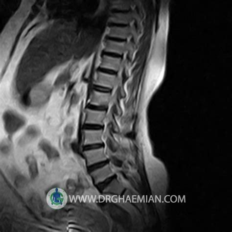 ام آر آی کمر چیست و چرا انجام می شود؟ مرکز تصویربرداری دکتر قائمیان