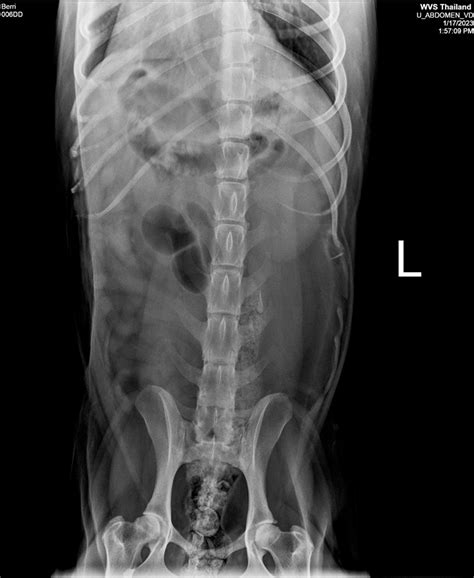 Figure 5 — A Ventrodorsal Radiograph Taken From The Dog In Figure 4