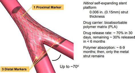 Dedicated Bifurcation Stents Intechopen