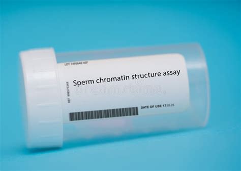 Sperm Chromatin Structure Assay Stock Image Image Of Assay Structure 277841343