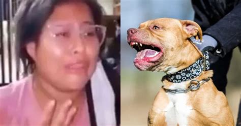 Perro Pitbull Desfiguró El Rostro A Niño De 2 Años Tras Feroz Ataque En