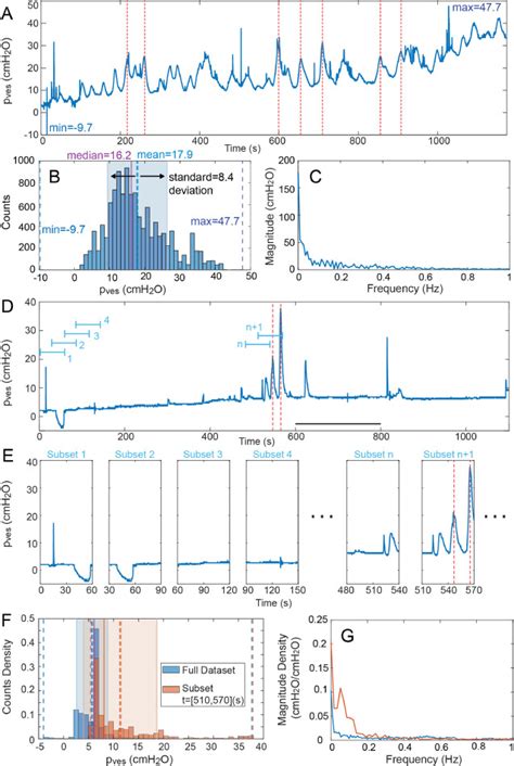 Machine Learning For Urodynamic Detection Of Detrusor Overactivity Urology