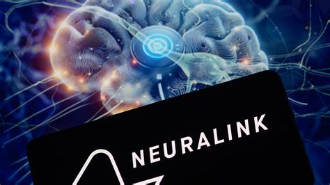 Neuralink Chip Lets Man Play Counter Strike With His Mind
