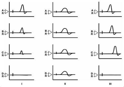 4 Spatiotemporal Characteristics Of Signals Recording The Signal