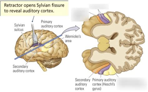 Auditory Cortex Diagram Quizlet