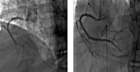 New Heart And Vascular Institute Capability Offers Hope For Complex