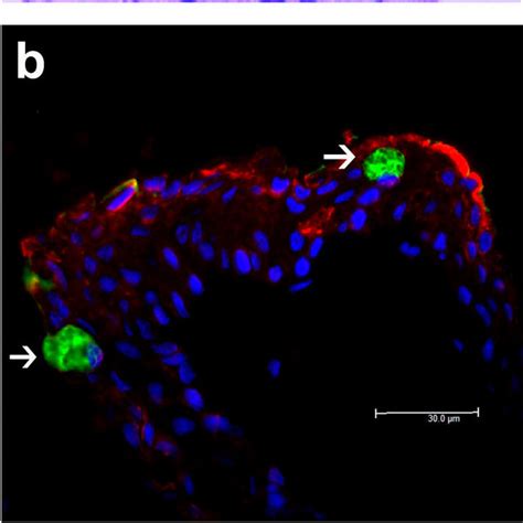Pdf Conjunctival Goblet Cell Function Effect Of Contact Lens Wear