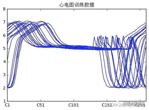 python深度学习实现自编码器Autoencoder神经网络异常检测心电图ECG时间序列 CSDN博客