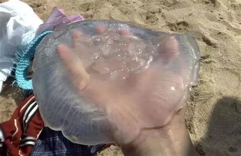 海蜇蜇人后的图片 海蜇蜇人后的症状图片 蜜蜂蜇人图片后图片 大山谷图库