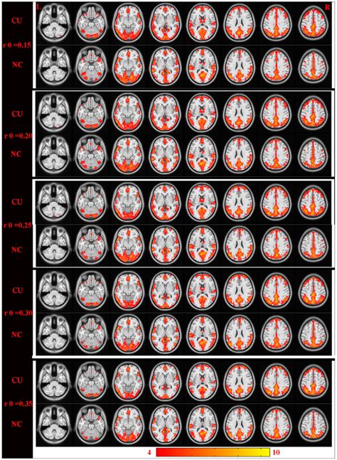 Cross Section View Intergroup Differences Were Highly Similar On The