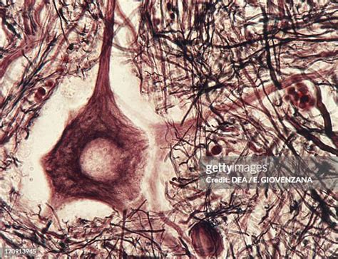 Multipolar Neuron Labeled Under Microscope