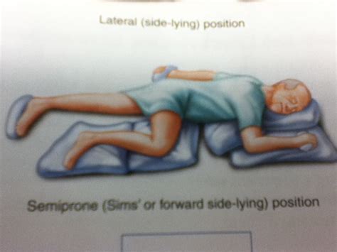Lateral Side Lying Position