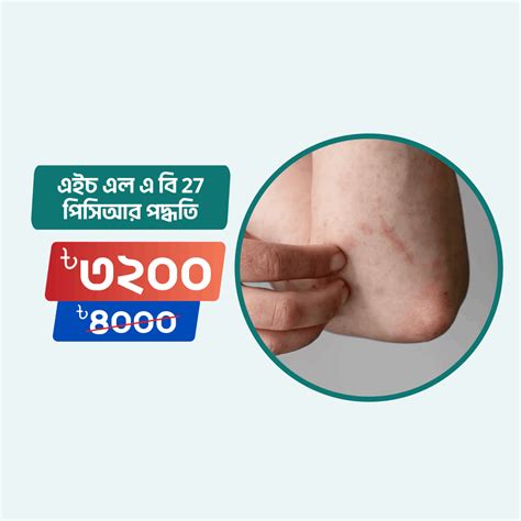 Hla B27 Pcr Method Arogga Online Lab