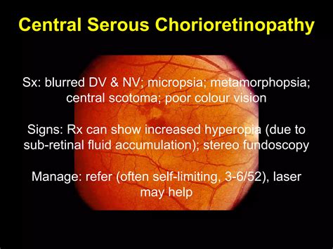 Ocular Diff Diaganosis 1 Ppt