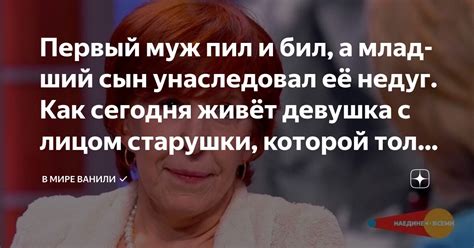 Первый муж пил и бил а младший сын унаследовал её недуг Как сегодня живёт девушка с лицом
