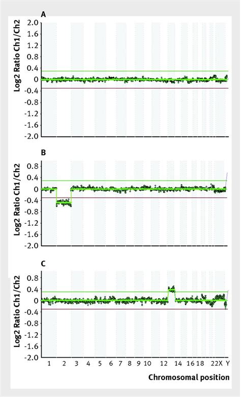 Samples Evaluated By Comparative Genomic Hybridisation Arrays For Pg Download Scientific