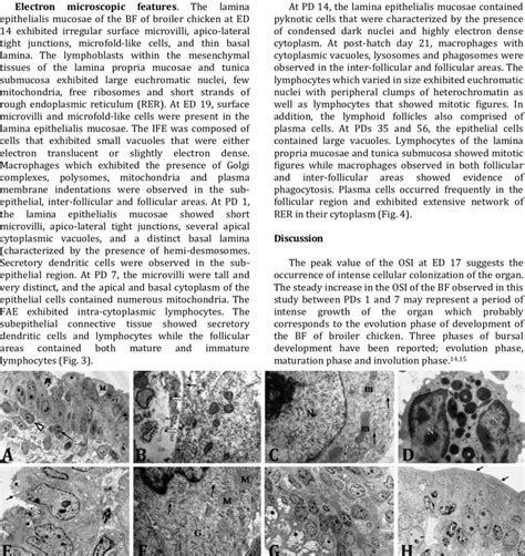 Transmission Electron Micrograph Of The Bursa Of Fabricius Of Broiler