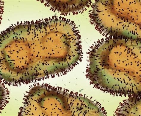 Nathalie Chacon Md Phd On Linkedin Monkeypox Us Canada