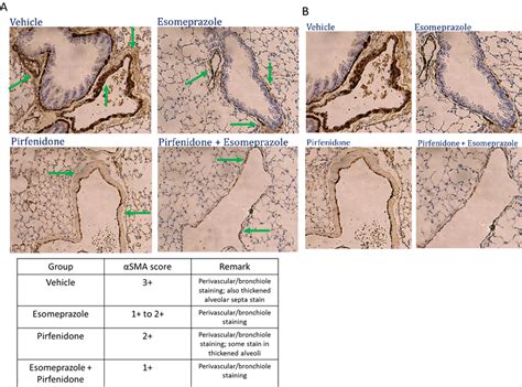 A Immunohistochemistry Data Showing Alpha Smooth Muscle Actin αsma Download Scientific