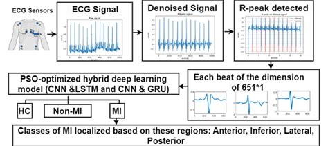 Pso Optimized Hybrid Deep Learning Model For Detection And Localization