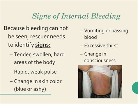 Ppt Soft Tissue Injuries Powerpoint Presentation Free Download Id