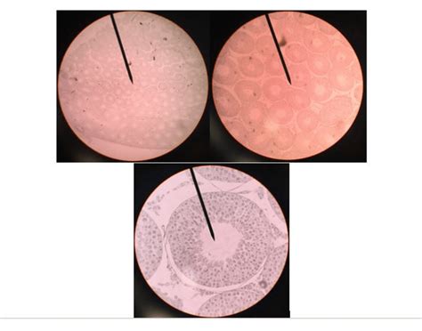 Male Testis Microscope Slide 1 2 Quiz