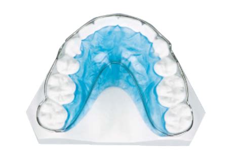 Types Of Retainers In Dentistry Removable Vs Permanent Dentalkart