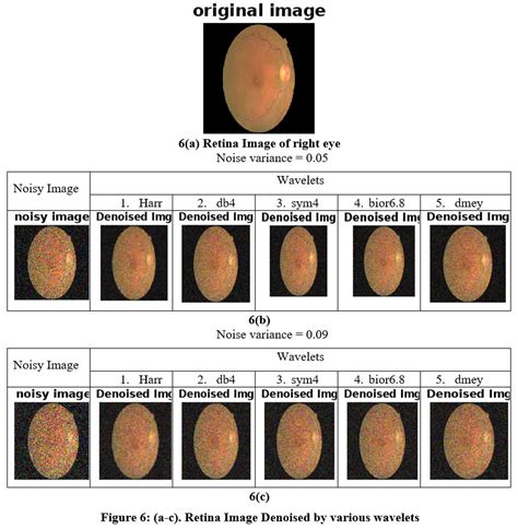 Multi Modal Medical Image Denoising Using Wavelets A Comparative Study Biomedical And