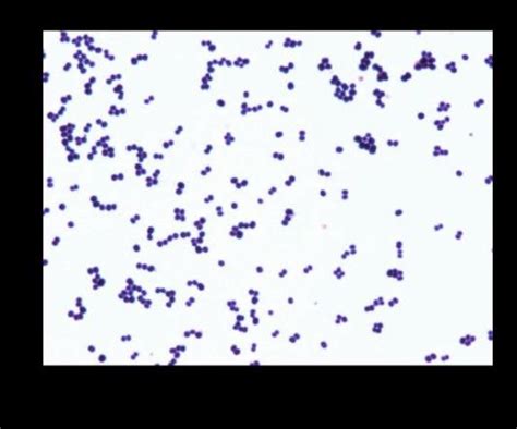 Solved What Is Cell Arrangement