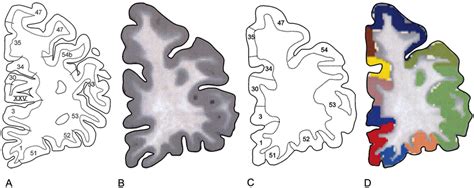 The Transfer Of The Myeloarchitectonic Parcellation Of A Section Download Scientific Diagram