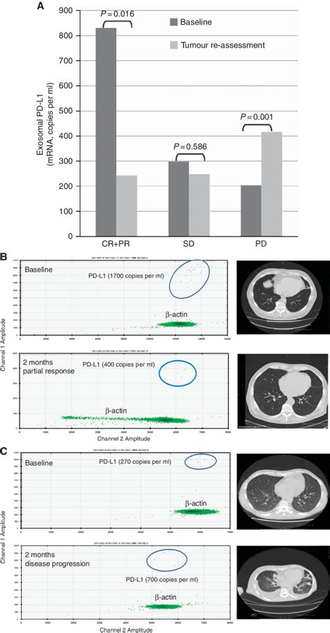 Effect Of Treatment With Anti Pd 1 Antibodies On Exosomal Pd L1 Download Scientific Diagram