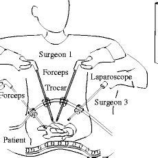 Conventional Laparoscopic Surgery Download Scientific Diagram