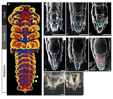 Embryonic Larval And Adult Development Of The Ovipositor A Scanning