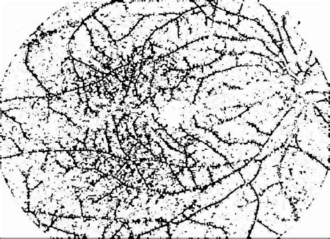 The Final Result Obtained By The Mathematical Morphology Approach Download Scientific Diagram