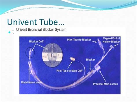 Bronchial Blockers And Endobronchial Tubes