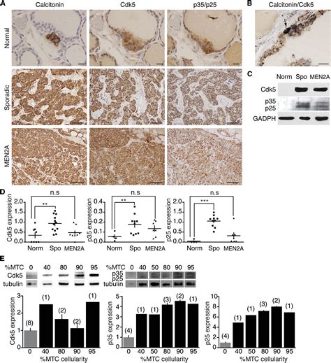 The Role Of Cdk5 In Neuroendocrine Thyroid Cancer Cancer Cell