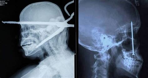 31 Funny X Ray Images That Seem Too Ridiculous To Be Real