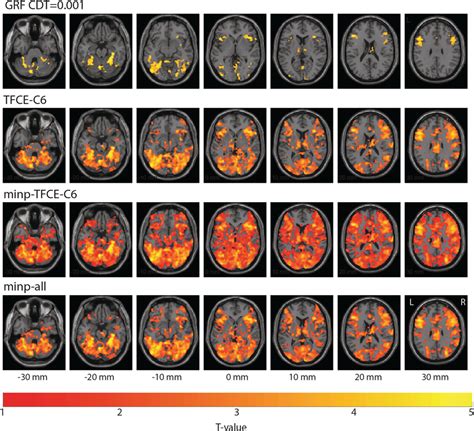 analyses of real task functional magnetic resonance imaging fmri