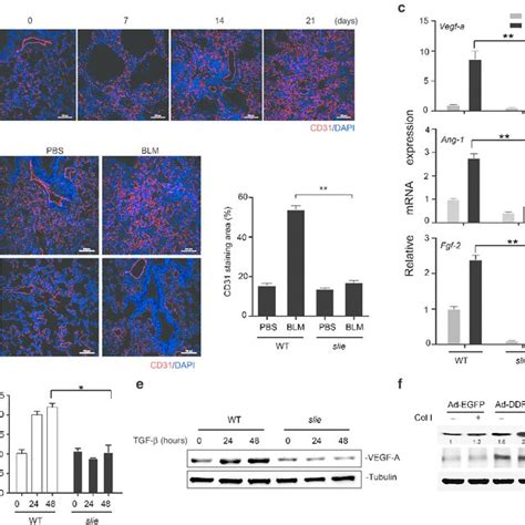 Pdf Targeting Of Discoidin Domain Receptor 2 Ddr2 Prevents Myofibroblast Activation And