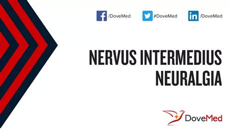 Nervus Intermedius Neuralgia Dovemed