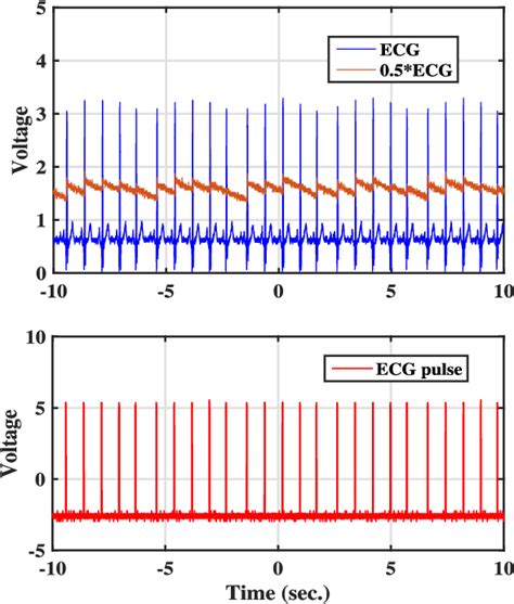 Figure 11 From A Fully Analog Autonomous Qrs Complex Detection And Low