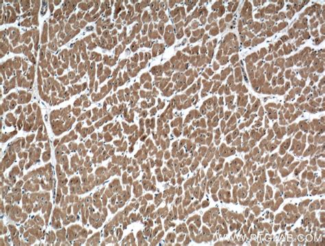 Usp5 Antibody 10473 1 Ap Proteintech