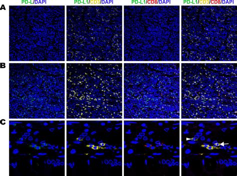 Fluorescent Multiplex Immunohistochemistry Mihc Staining Pattern For