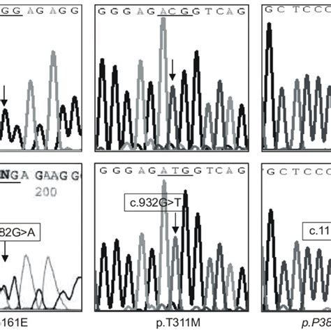 Single Nucleotide Polymorphism In The Mecp2 Gene Identified By Direct