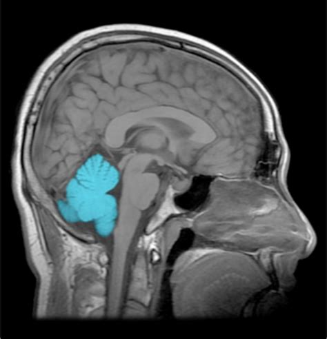 Aandpi Lab Practical Iii Terms And Definitions For Visual Arts Flashcards