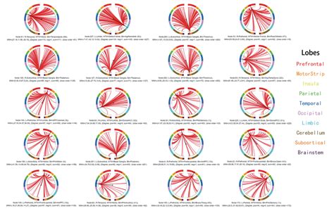 教育学院李海江副教授团队在social cognitive and affective neuroscience期刊上发表最新研究成果